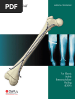 Zimmer Natural Nail System Tibial Nail Surgical Technique | PDF | Screw ...