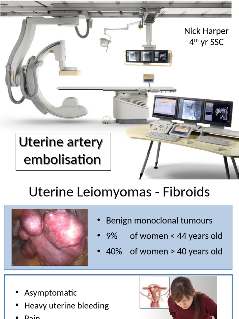 Uterine Artery Embolisation2563 160118115134 | PDF | Clinical Medicine ...