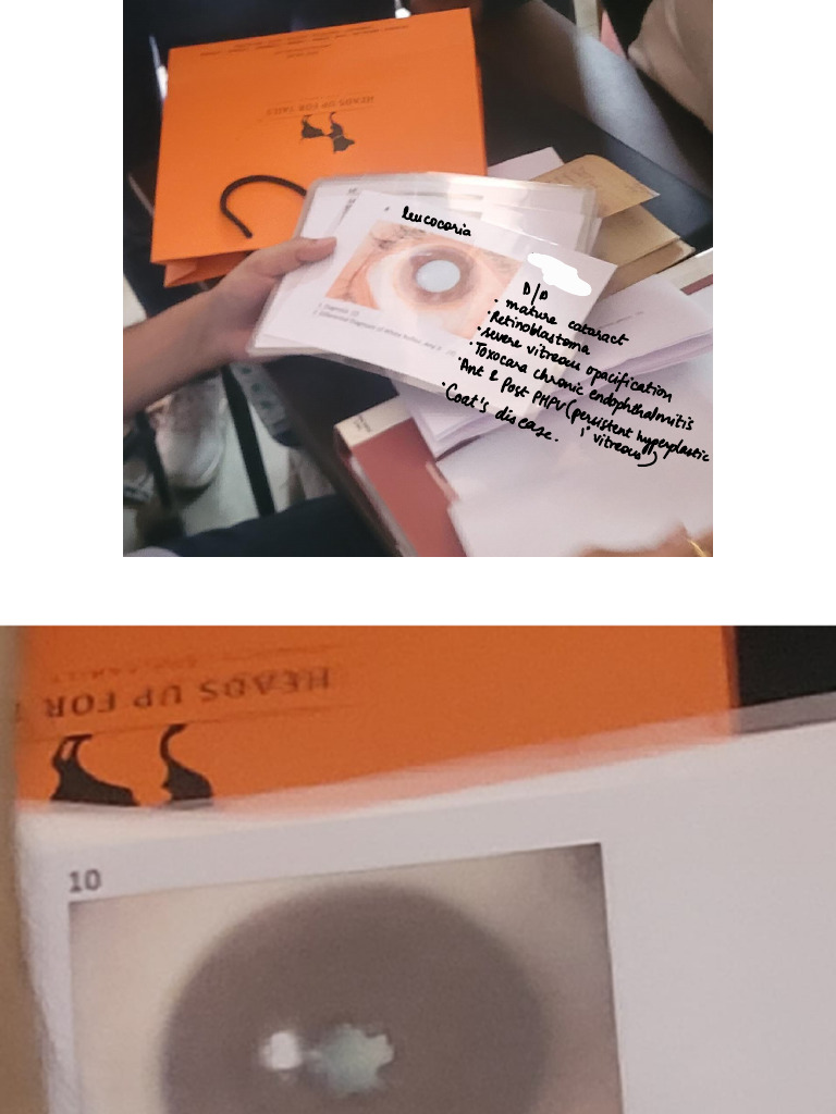 Ophthalmology Osce | PDF