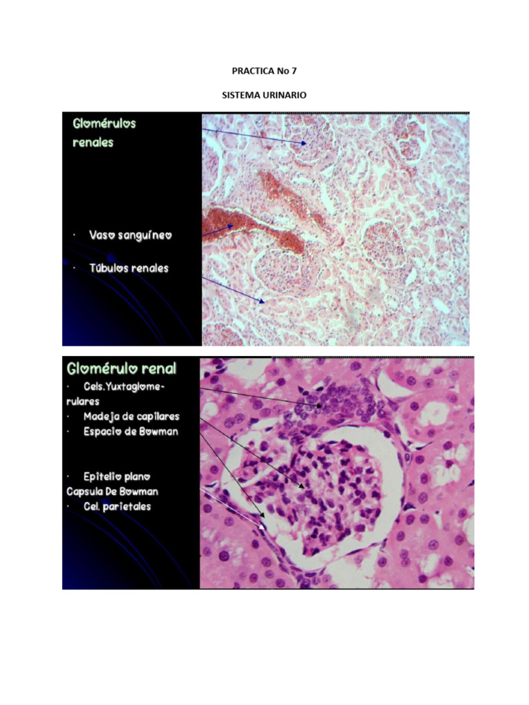 Practica Sistema Urinario | PDF