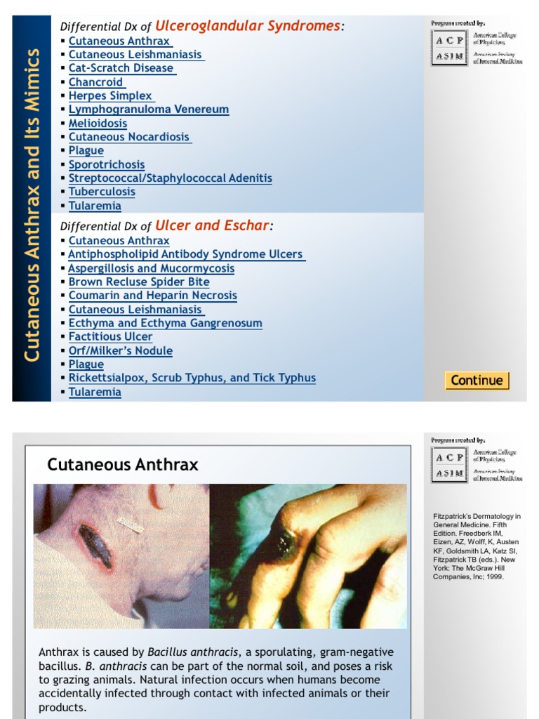 A Comprehensive Review of Cutaneous Ulcers and Eschars: Differential ...