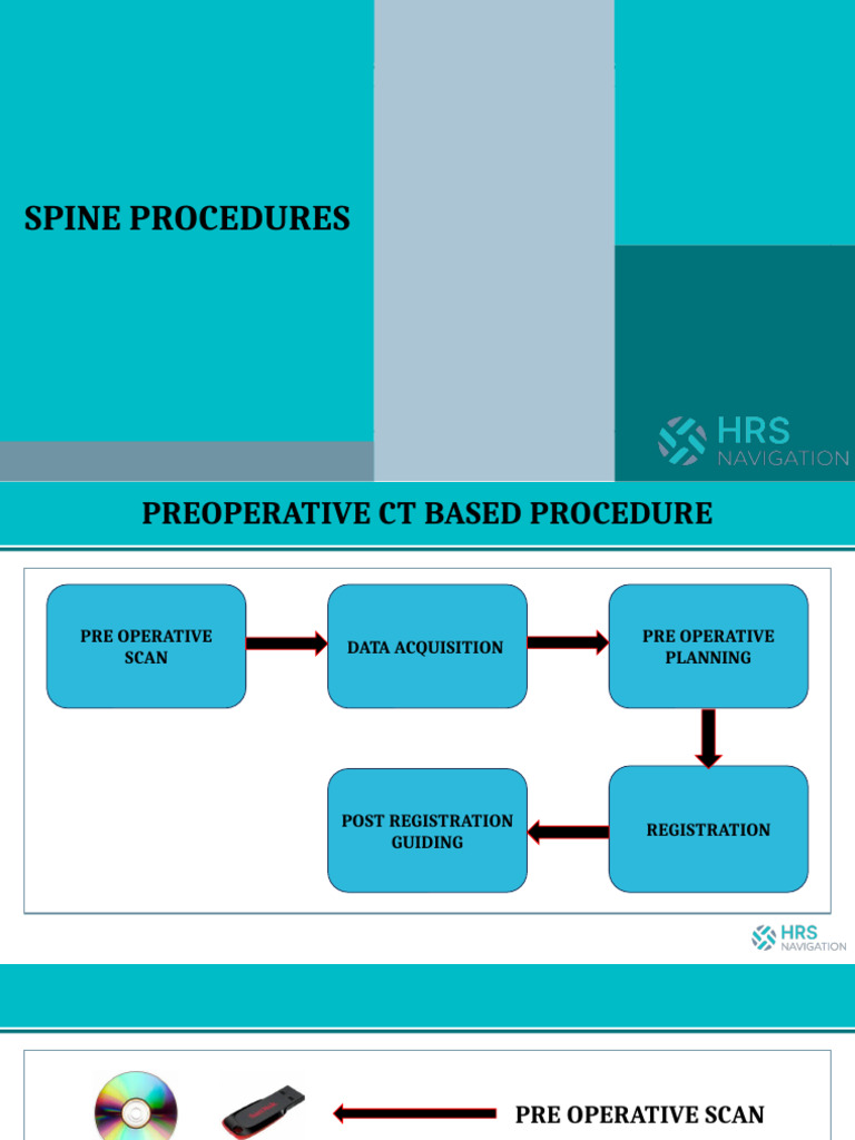 Spine Navigation | PDF | Vertebral Column | Ct Scan