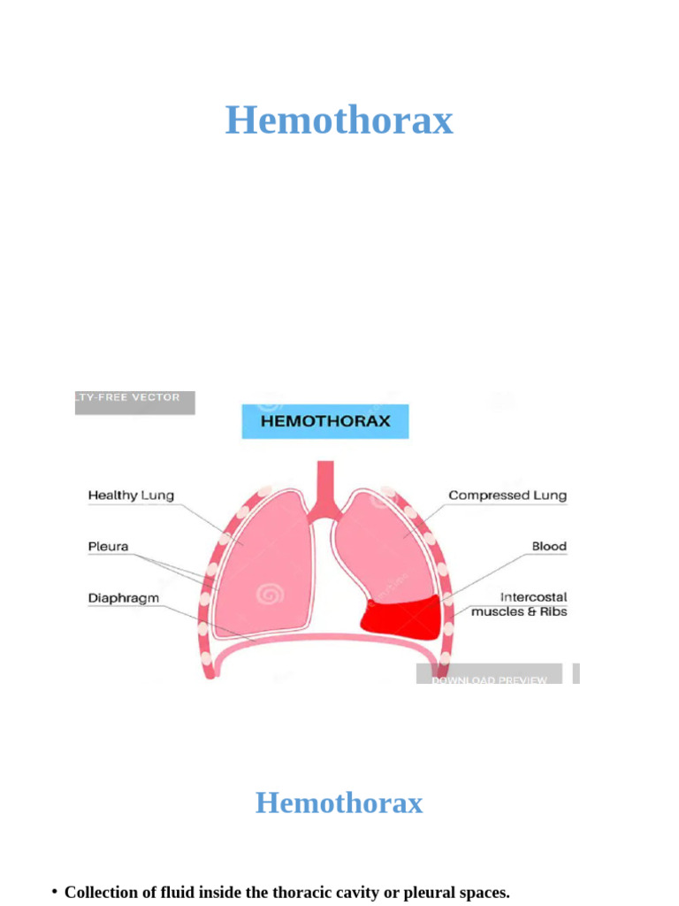 Nursing Care for Hemothorax Management | PDF