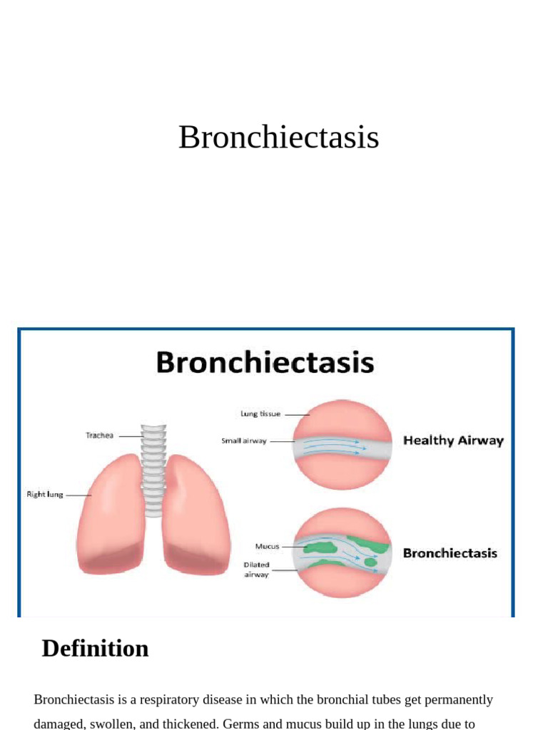 Bronchiectasis | PDF | Lung | Respiratory Tract