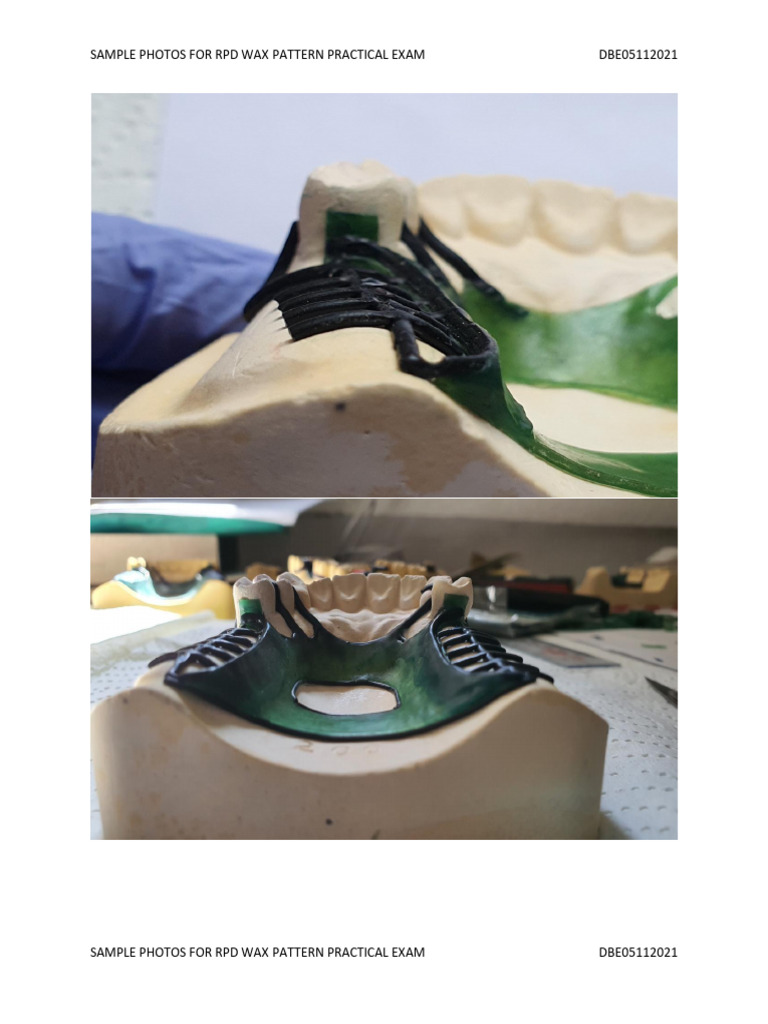 RPD Sample Photographs | PDF