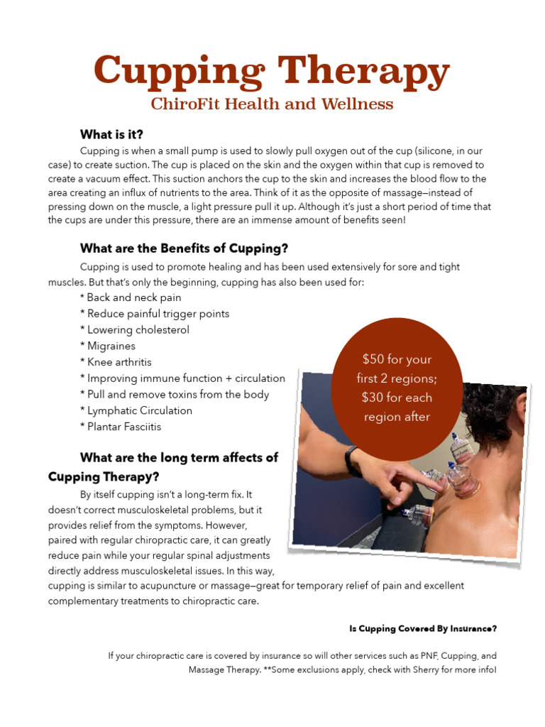 Cupping Therapy Flyer 1 | PDF