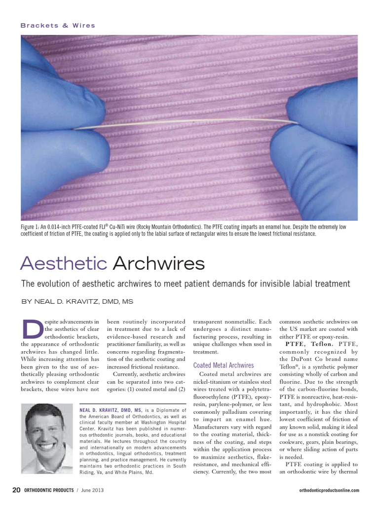 Ortho Products Arch Wire Article DR Kravitz | PDF | Epoxy | Orthodontics