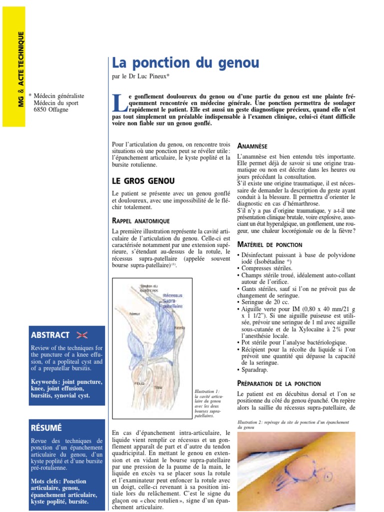 Ponction genou | Genou | Articulation (anatomie)