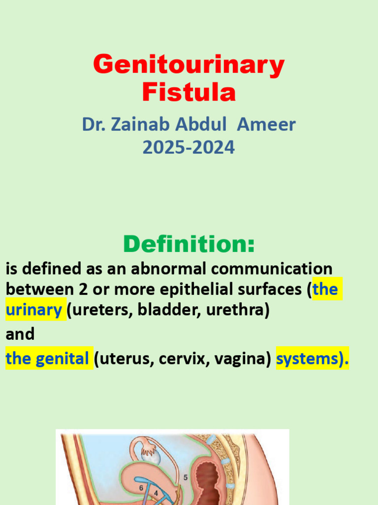 Genitourinary Fistula 2025 | PDF | Vagina | Urinary Incontinence