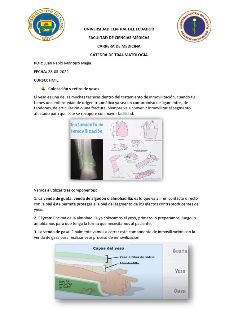 Colocación de yesos | PDF | Tobillo | Mano