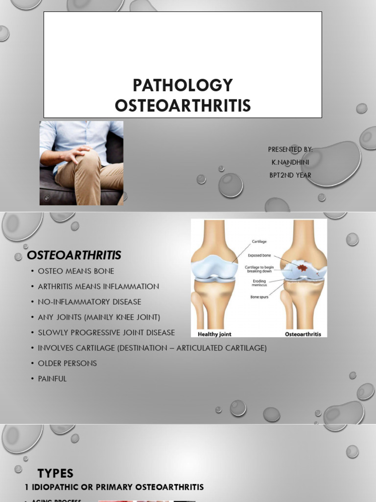 Pathology Osteoarthritis: Presented By: K.Nandhini Bpt2Nd Year | PDF