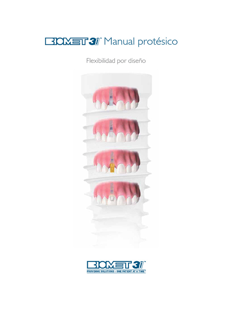 3i Manual Protésico ES | PDF | Implante dental | Tornillo