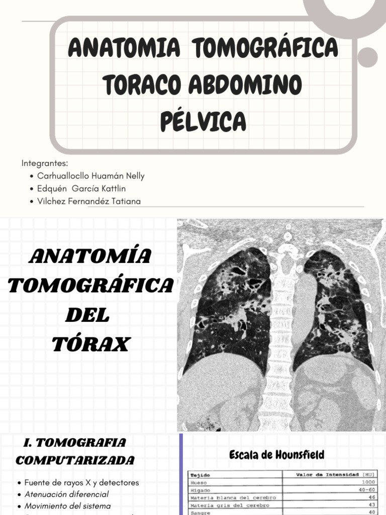 Anatomía Tomográfica Toraco Abdomino Pélvica | PDF | Abdomen | Pelvis
