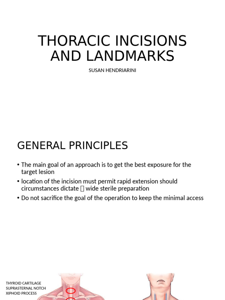 Thoracic Incisions and Landmarks | PDF