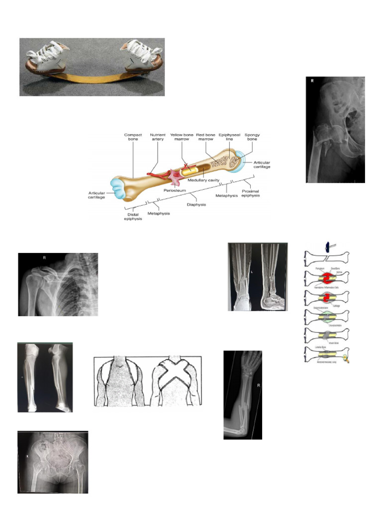 Ortho | PDF