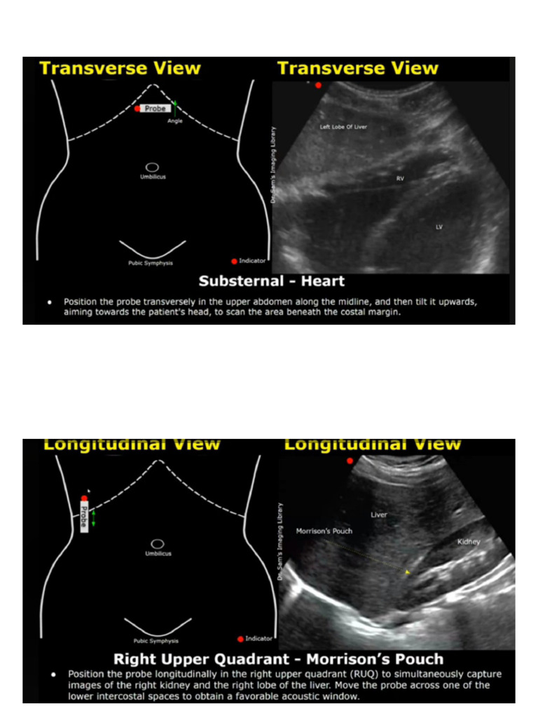 FAST Probe positioning | PDF