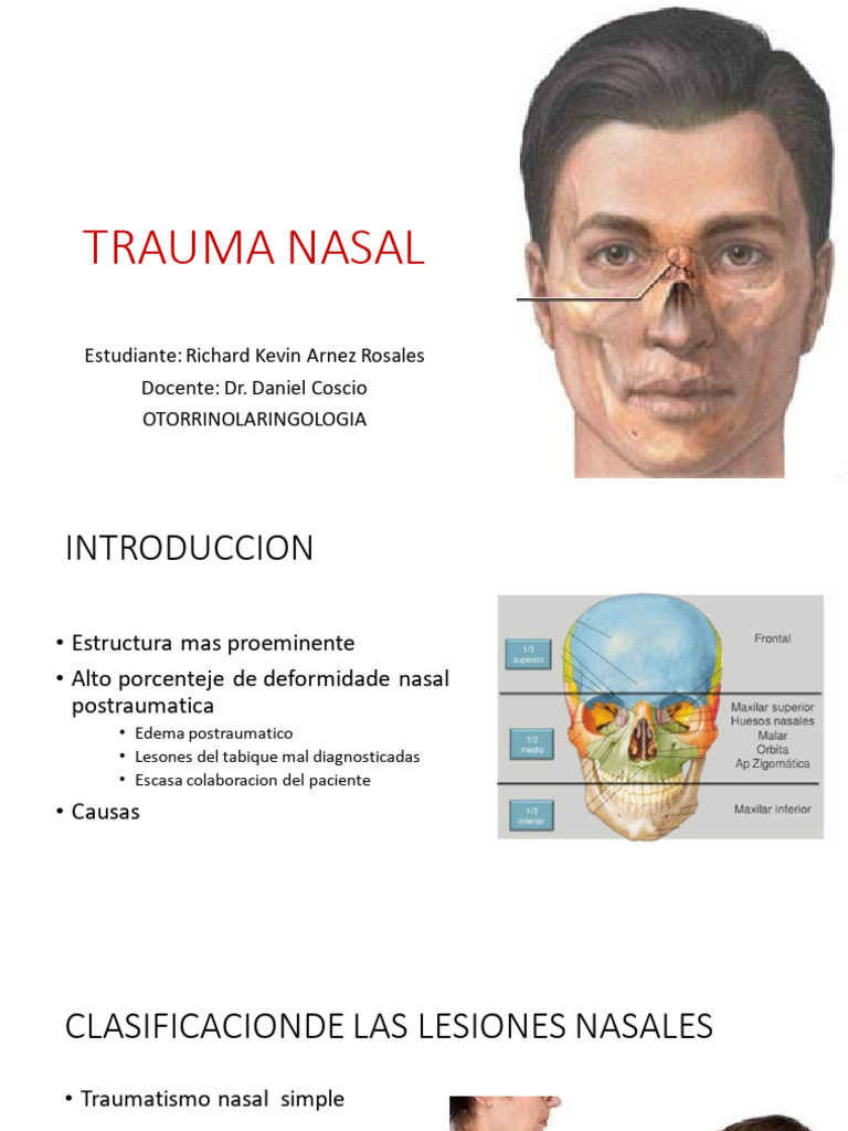 TRAUMA NASAL | PDF