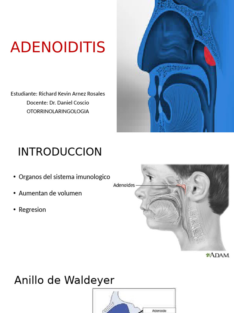 ADENOIDITIS | PDF