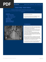 Chest X-Ray Findings in Heart Failure | PDF | Heart Failure | Lung
