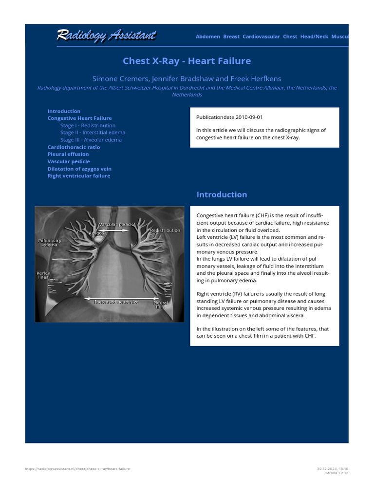 Chest X-Ray Findings in Heart Failure | PDF | Heart Failure | Vein