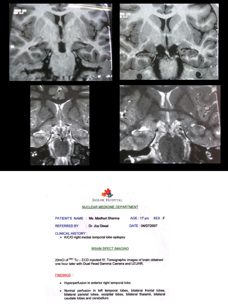 Madhuri Sharma MRI | PDF