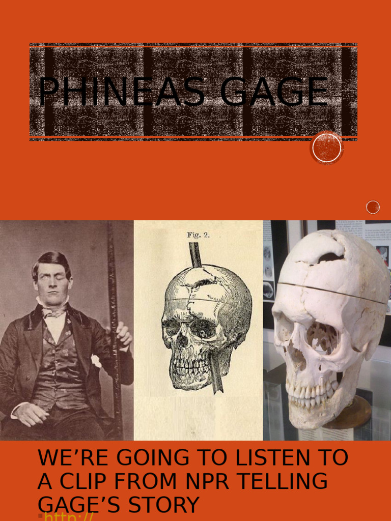 Phineas Gage | PDF