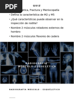Anomalías de Transición Lumbosacra Por Tc. Método Castellvi | PDF | Vértebra | Sistema ...