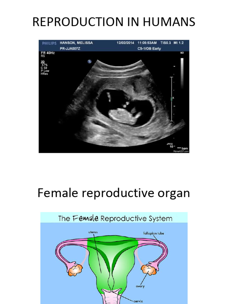 Chapter 14 Reproduction in Humans | PDF | Fetus | Sperm