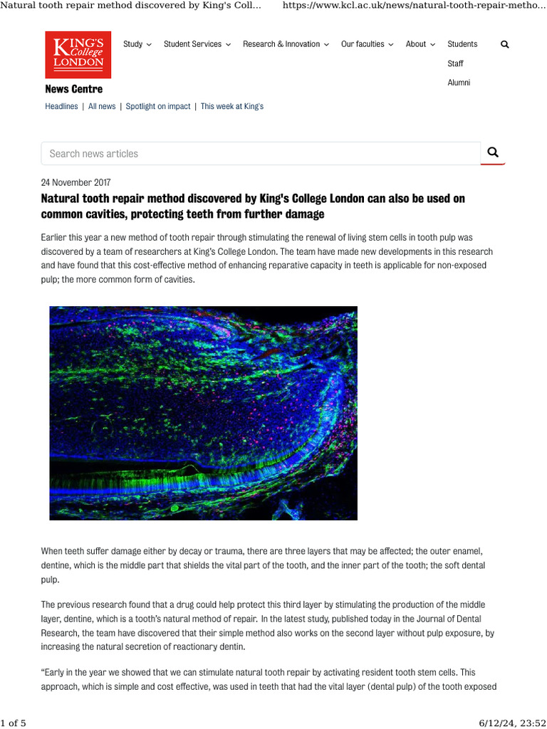 Natural Tooth Repair Method Discovered by King's College London Can ...