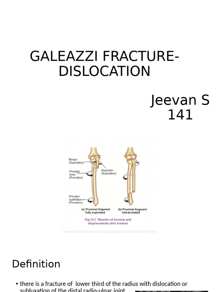 Galeazzi Fracture-Dislocation | PDF