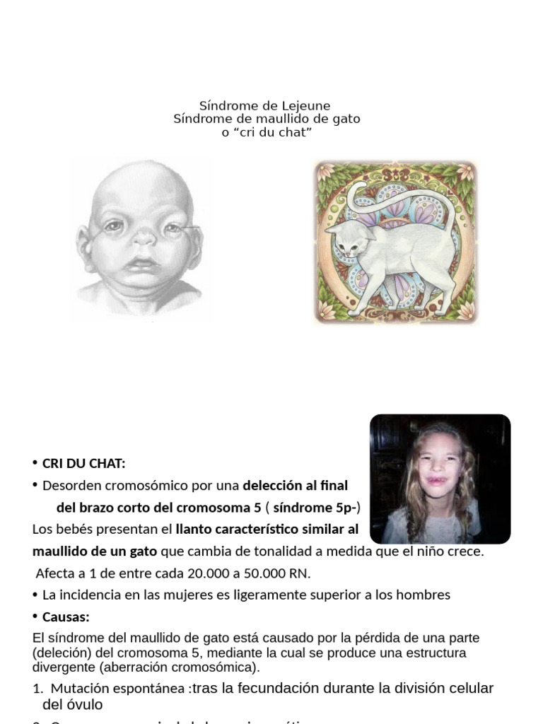 Síndrome de Maullido de Gato: Cri du Chat | PDF | Causas de la muerte ...