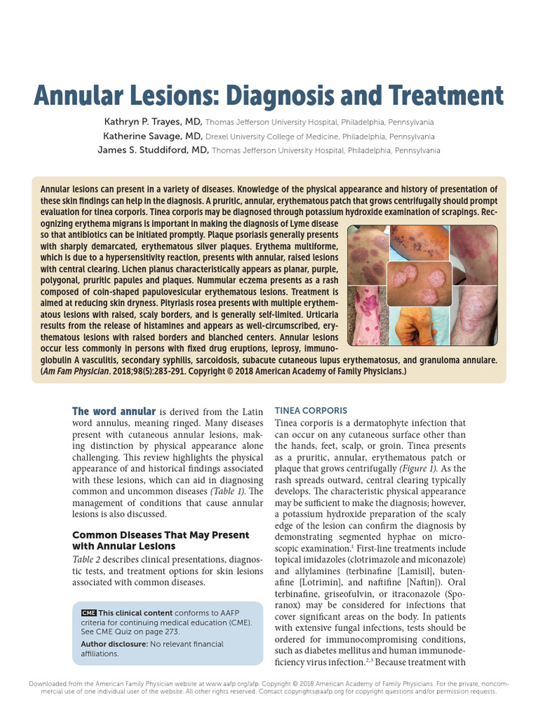 Annular Lesions | PDF | Psoriasis | Dermatitis