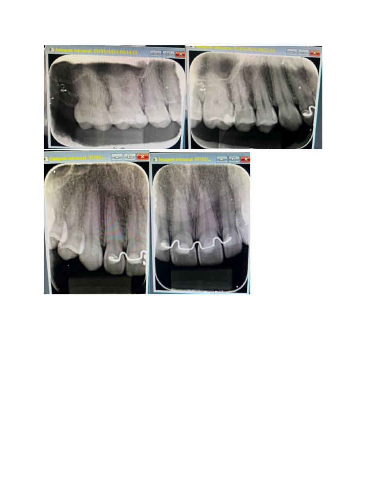 Radiografias Rayane | PDF