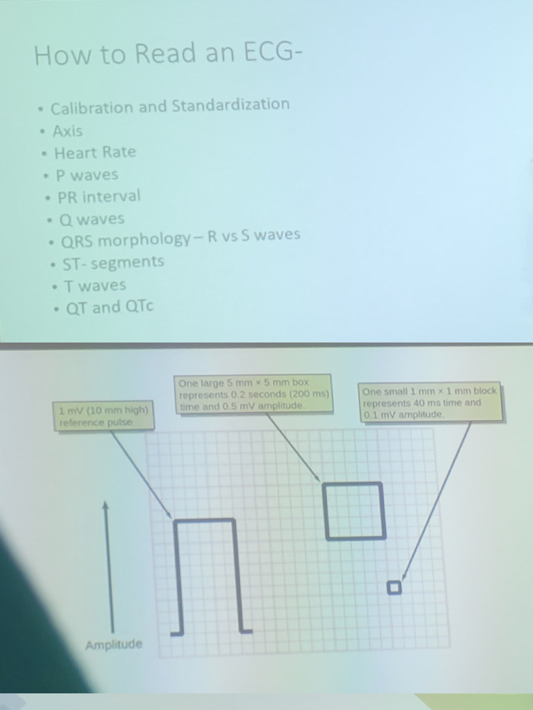 Ecg | PDF | Electrocardiography | Cardiac Electrophysiology