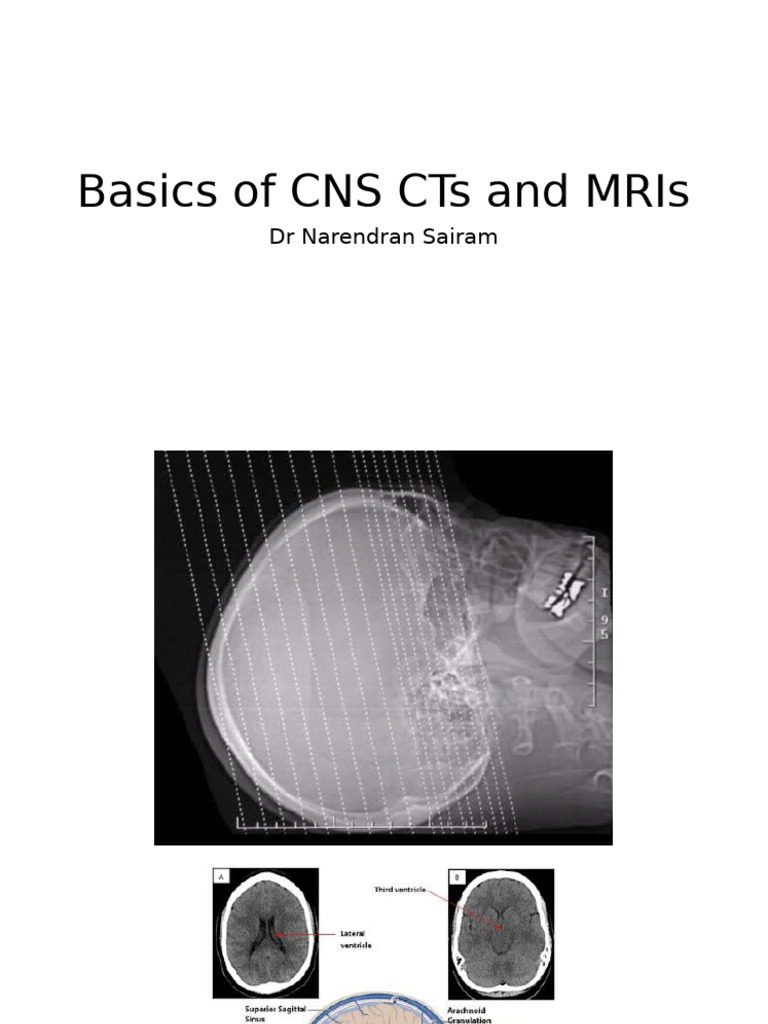 CNS Imaging Basics | PDF
