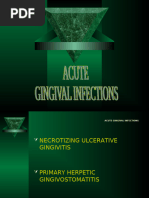 Linear Gingival Erythema | PDF | Periodontology | Medicine