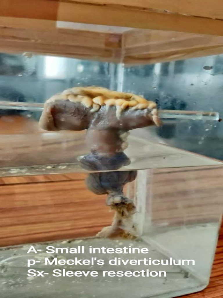 Surgery Specimens | PDF