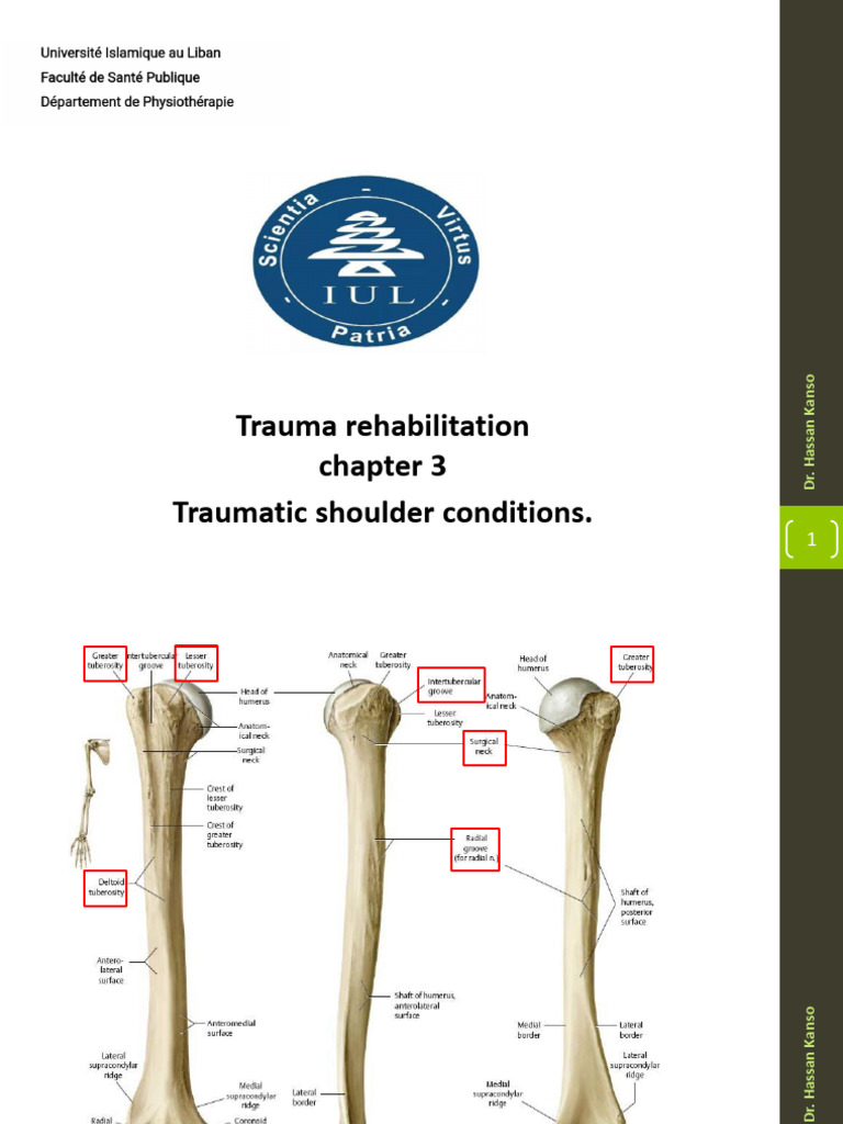 Trauma 3 - Shoulder Fx | PDF | Anatomical Terms Of Motion | Shoulder