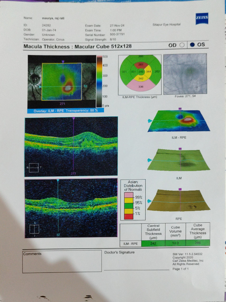 Peak method | PDF | Human Eye | Ophthalmology