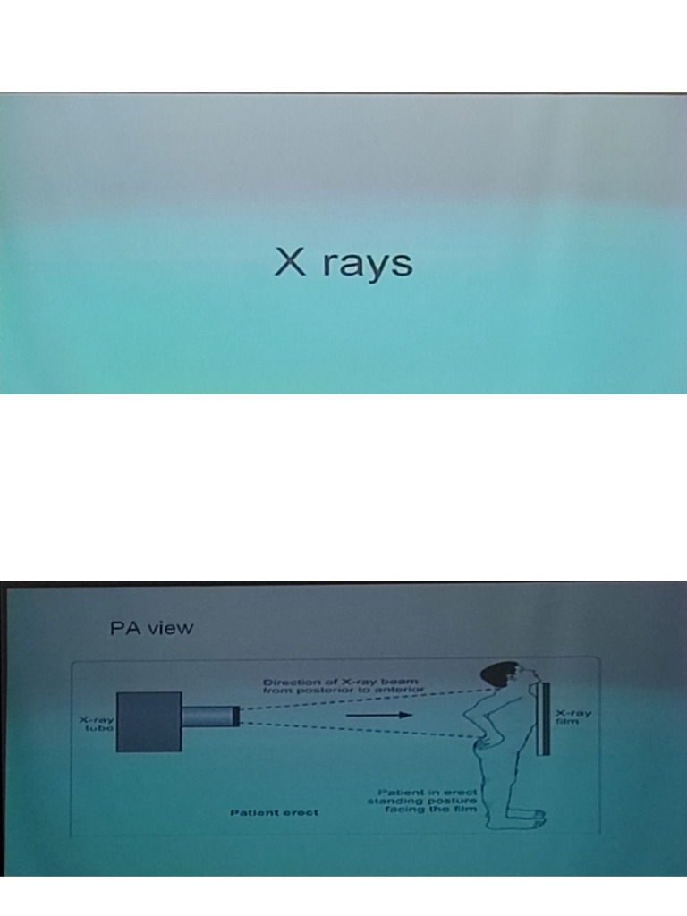 Paeds XR | PDF