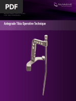 PROPHECY INBONE Surgical Technique | PDF | Ct Scan | Medical Imaging