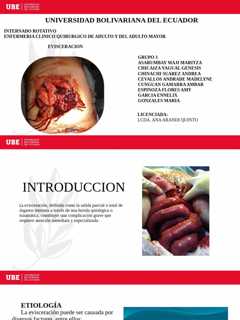 Evisceración: Diagnóstico y Tratamiento | PDF | Cirugía | Abdomen