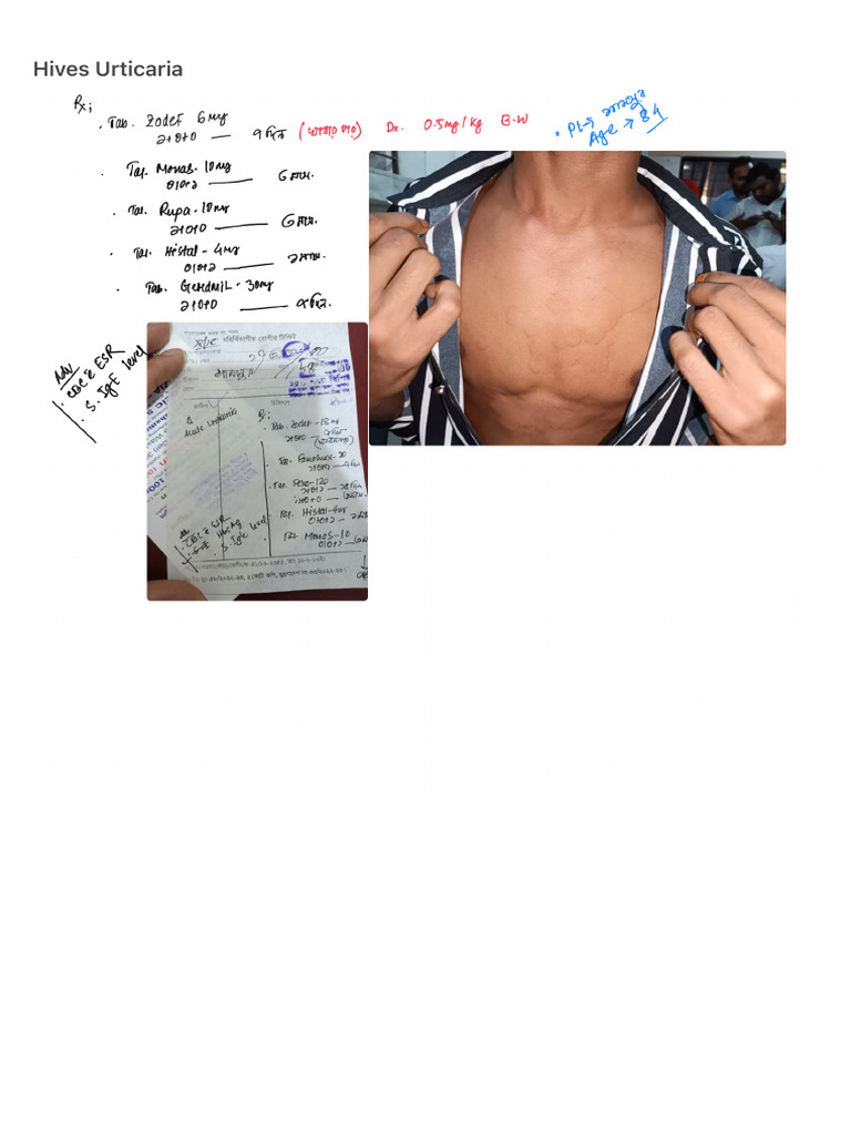 Hives Urticaria | PDF
