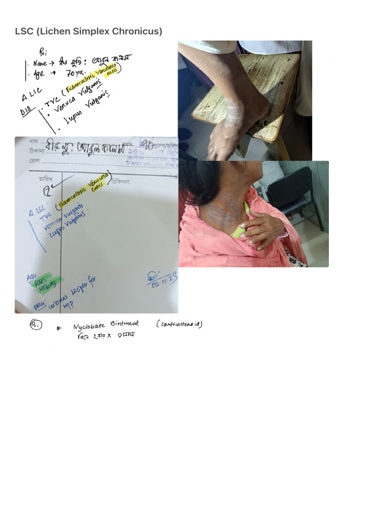 LSC (Lichen Simplex Chronicus) | PDF