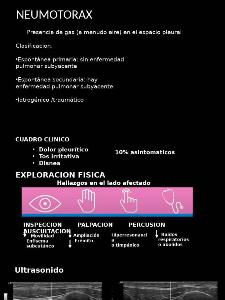 Neumotórax: Clasificación y Tratamiento | PDF | Medicina CLINICA ...