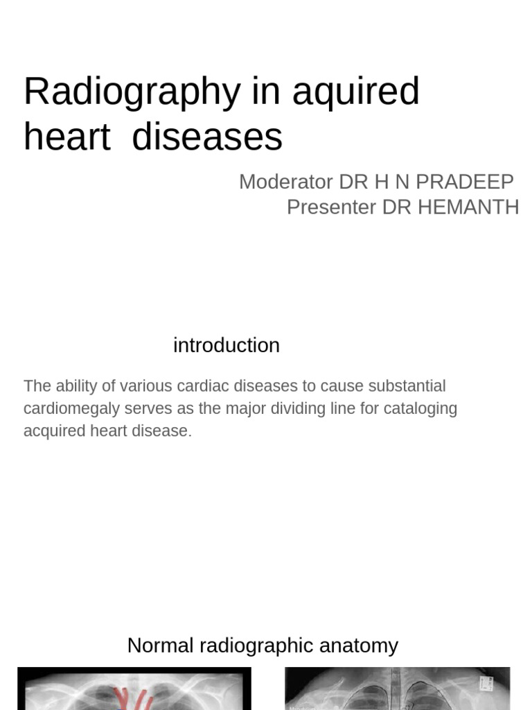 Acquired Heart Disease New | PDF | Heart | Heart Valve