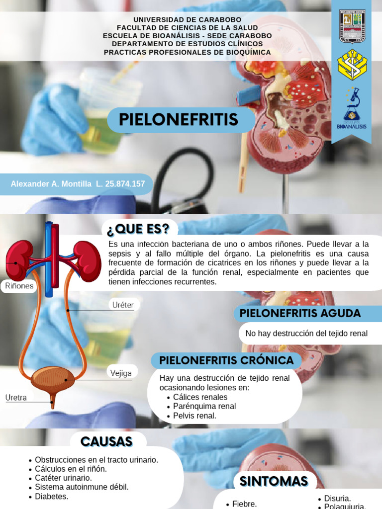 Pielonefritis: Causas y Diagnóstico Clínico | PDF | Epidemiología ...
