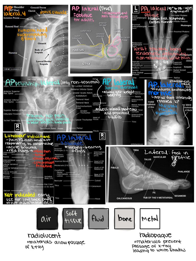 Imaging and Skeletal Pathology | PDF | Bone | Back Pain