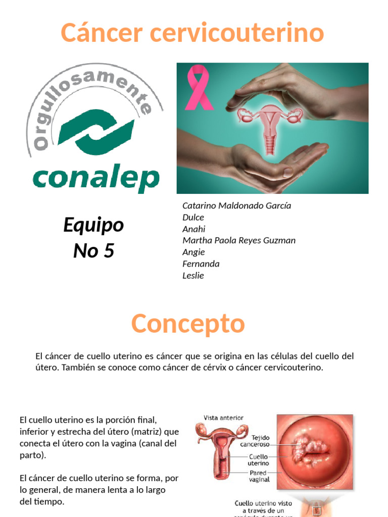 Cáncer cervicouterino | PDF