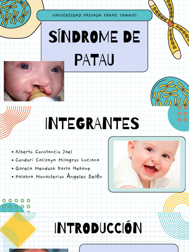 Sd de patau | PDF | Citogenética | Nucleo celular